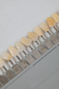 Expert Denture Teeth Mould Guide | Your Path to a Natural Smile